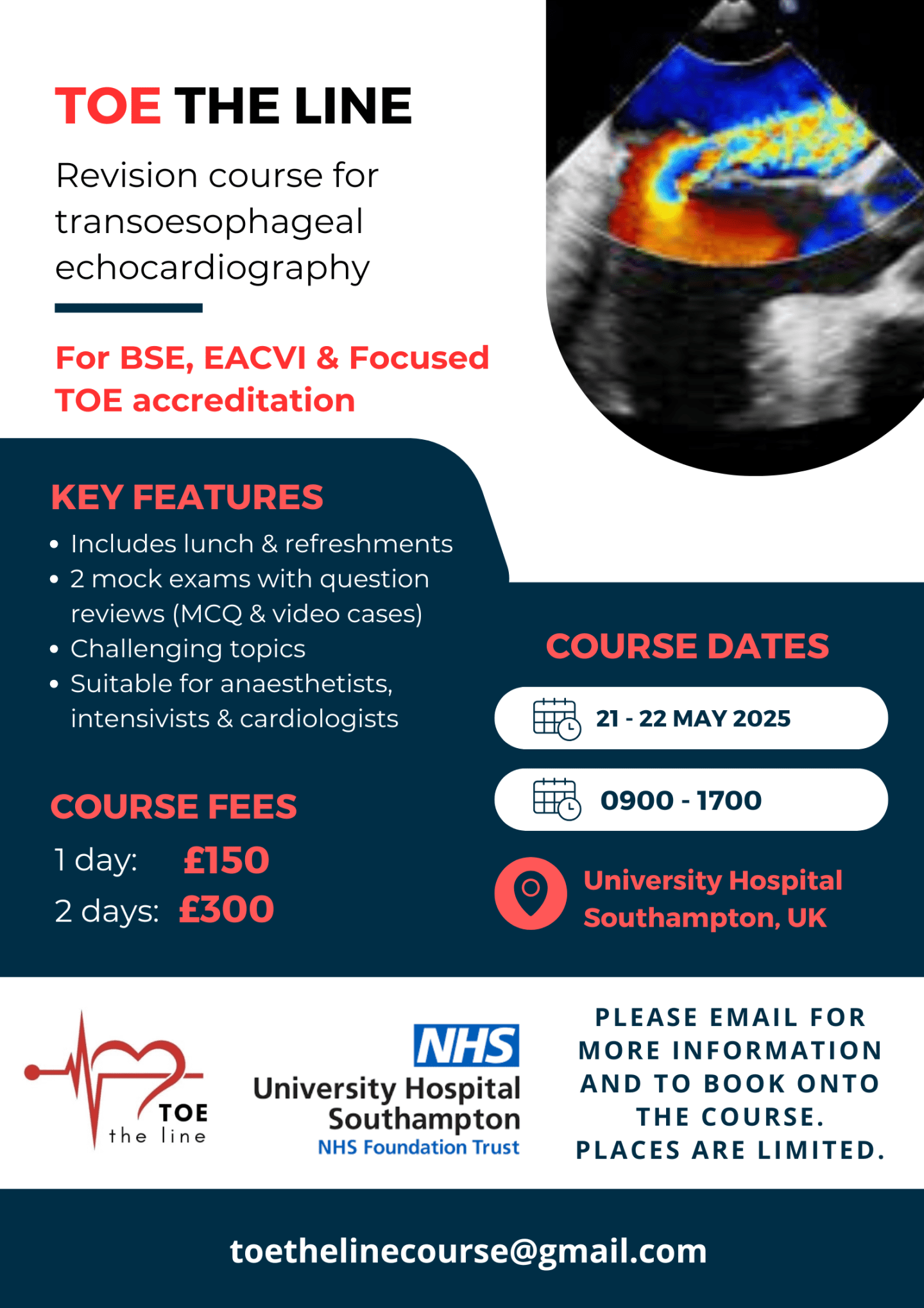 TOE the line – Southampton Cardiac Anaesthesia